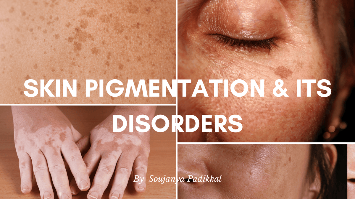 Skin Pigmentation & Its Disorders – Earthy Sapo